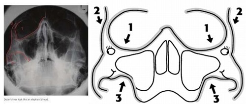 Medicine Decoded: Lines of Dolan and the elephants of Rogers